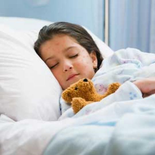 Rujeola (pojar) la copii | SfatulMamicilor.ro